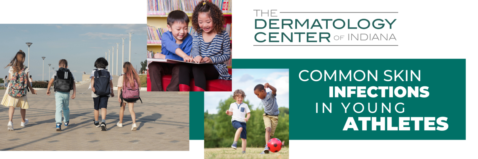 Skin Infections in Young Athletes | The Dermatology Center of Indiana